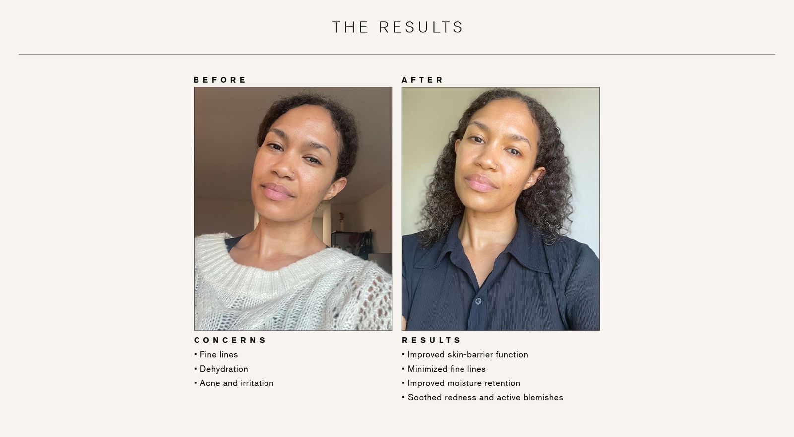 Reviewed: Symbiome's The Answer Reparative Serum | Who What Wear