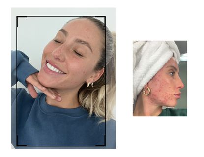 Alix Earle Has Beauty Secrets You Haven't Seen on TikTok | Who What Wear