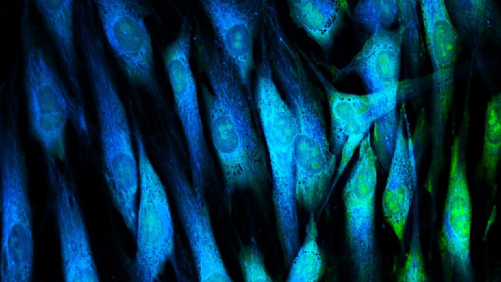 Skin cells made 30 years younger with new 'rejuvenation' technique ...