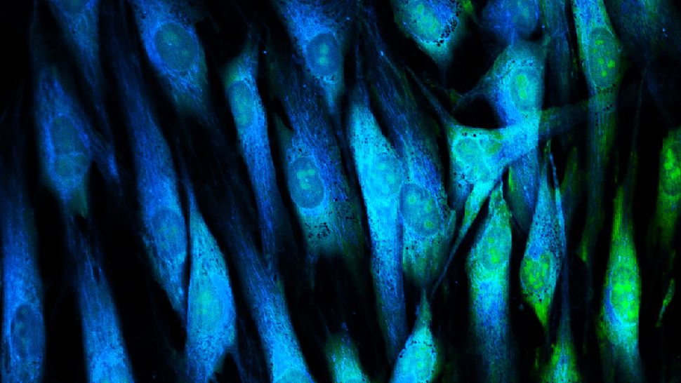 Skin cells made 30 years younger with new 'rejuvenation' technique ...