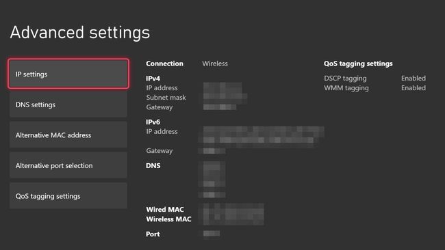 How to give your Xbox Series X|S or Xbox One a Static IP address ...
