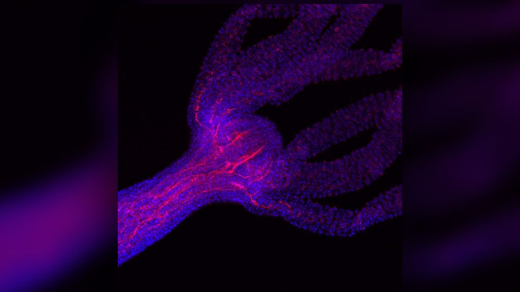 Here's the secret to how 'immortal' hydras regrow severed heads | Live ...