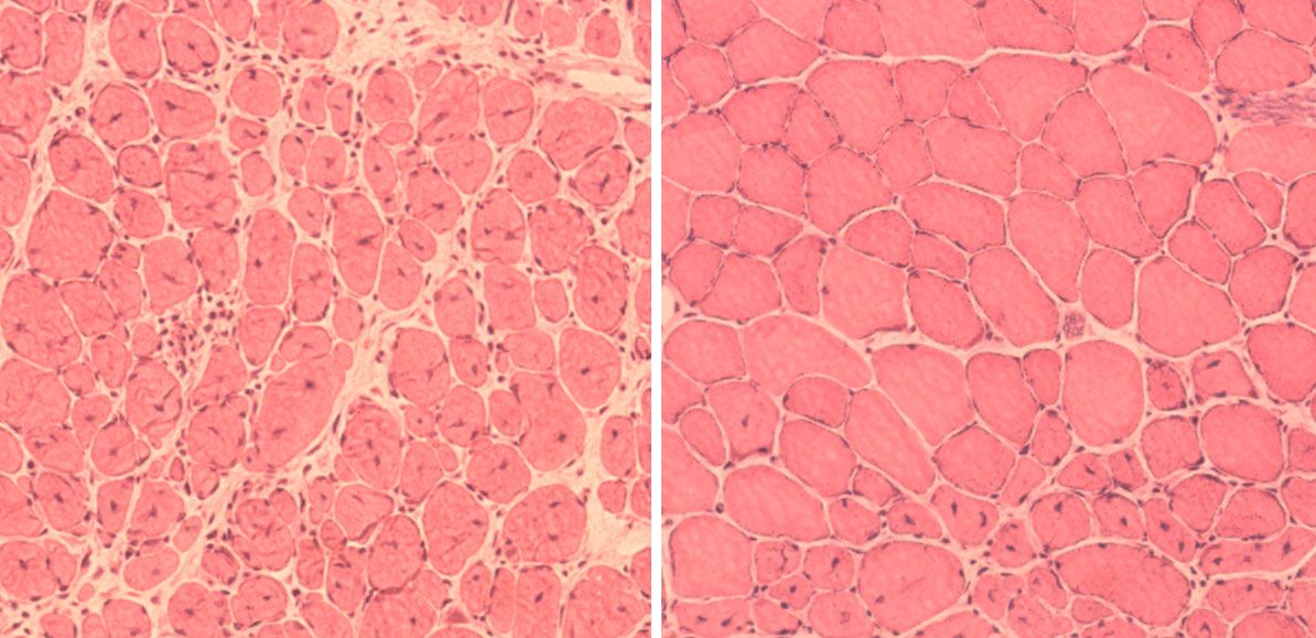 Aging May Be Reversible: Researchers Rejuvenate Older Mice | Live Science