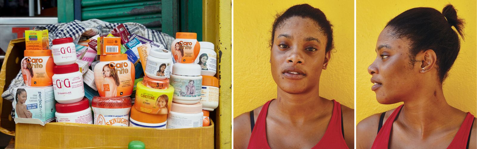 Skin Bleaching - How and Why These Black Women Bleach Their Skin ...