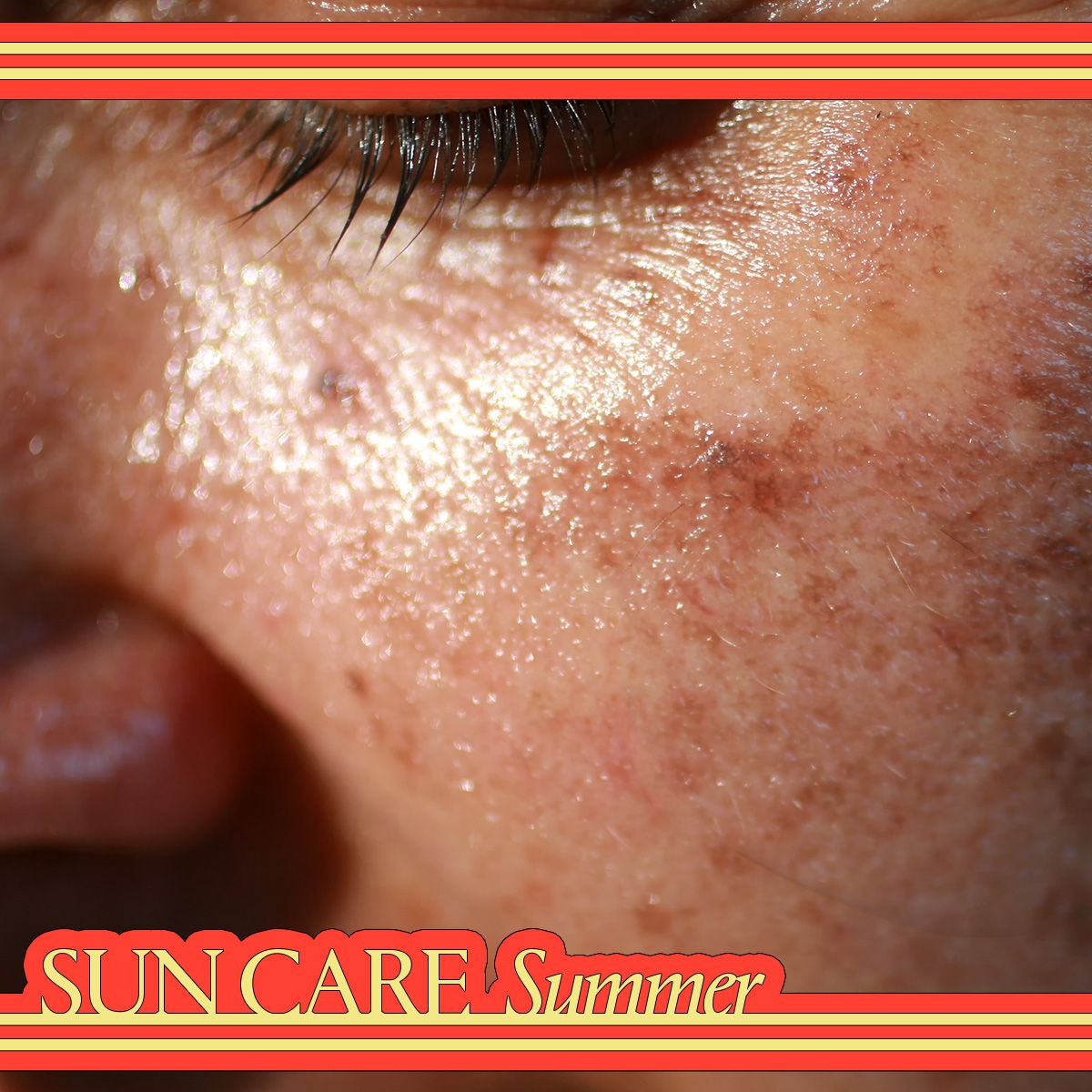 What Is the Melanotan II Tanning Injection? | Marie Claire