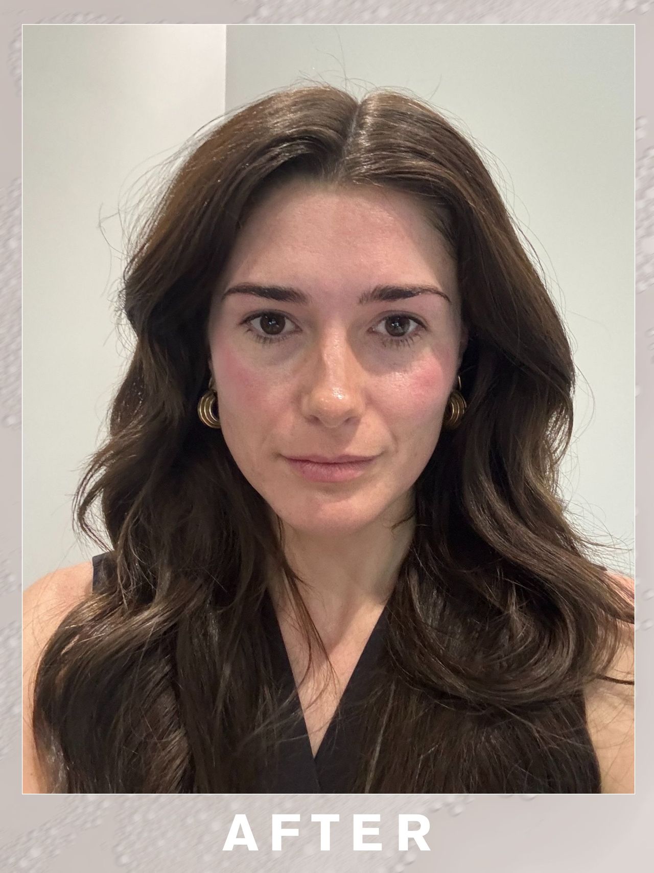 Sofwave Brow Lift Reviewed by a Beauty Editor | Who What Wear