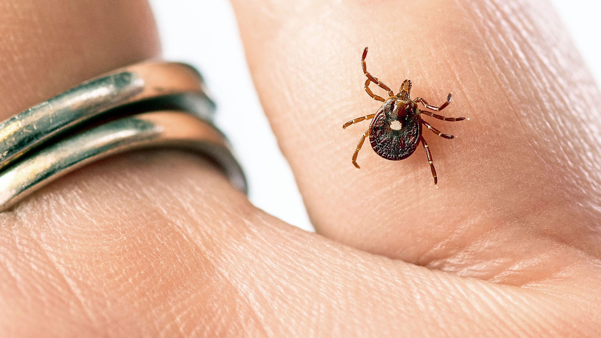 The Week Unwrapped: How does a tiny tick turn people vegan? | The Week