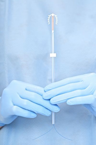 IUD Insertion Process - How Much Does It Hurt to Get an IUD? | Marie Claire