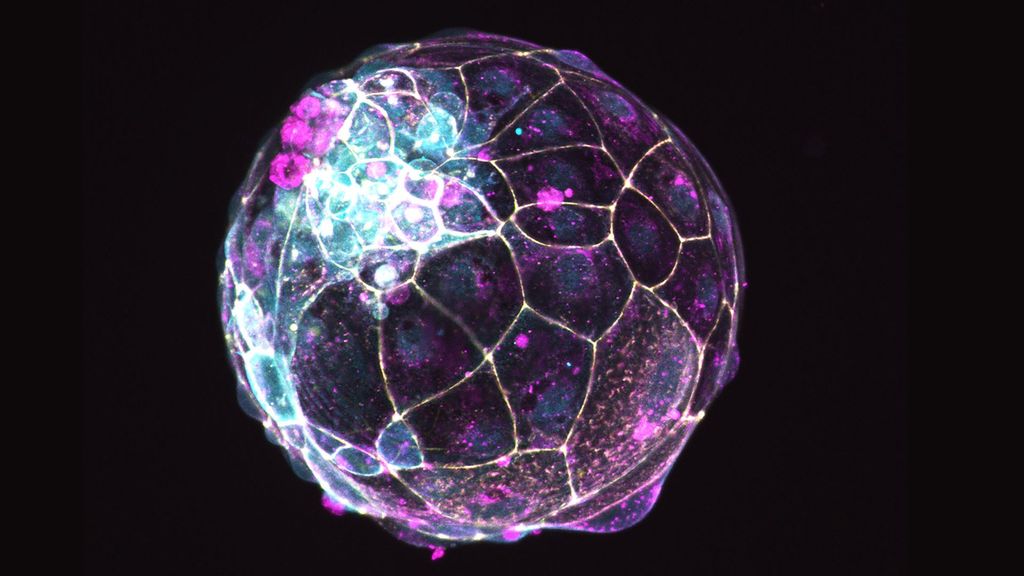 Should we rethink our legal definition of a human embryo? | Live Science