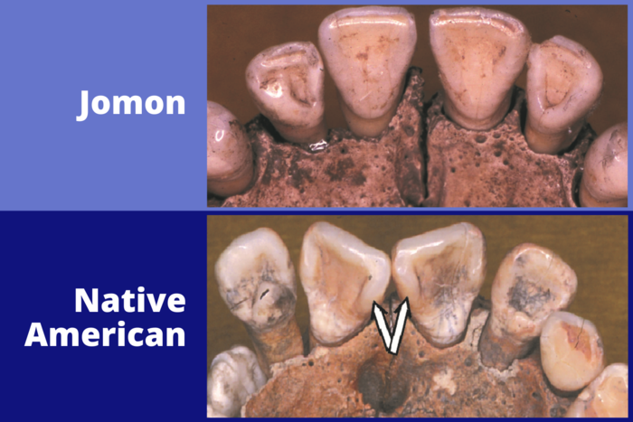 Analysis of ancient teeth questions theory that Native Americans ...