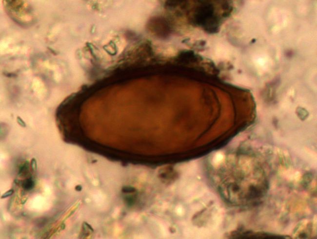 Ancient Rome Was Infested with Human Parasites, Poop Shows | Live Science