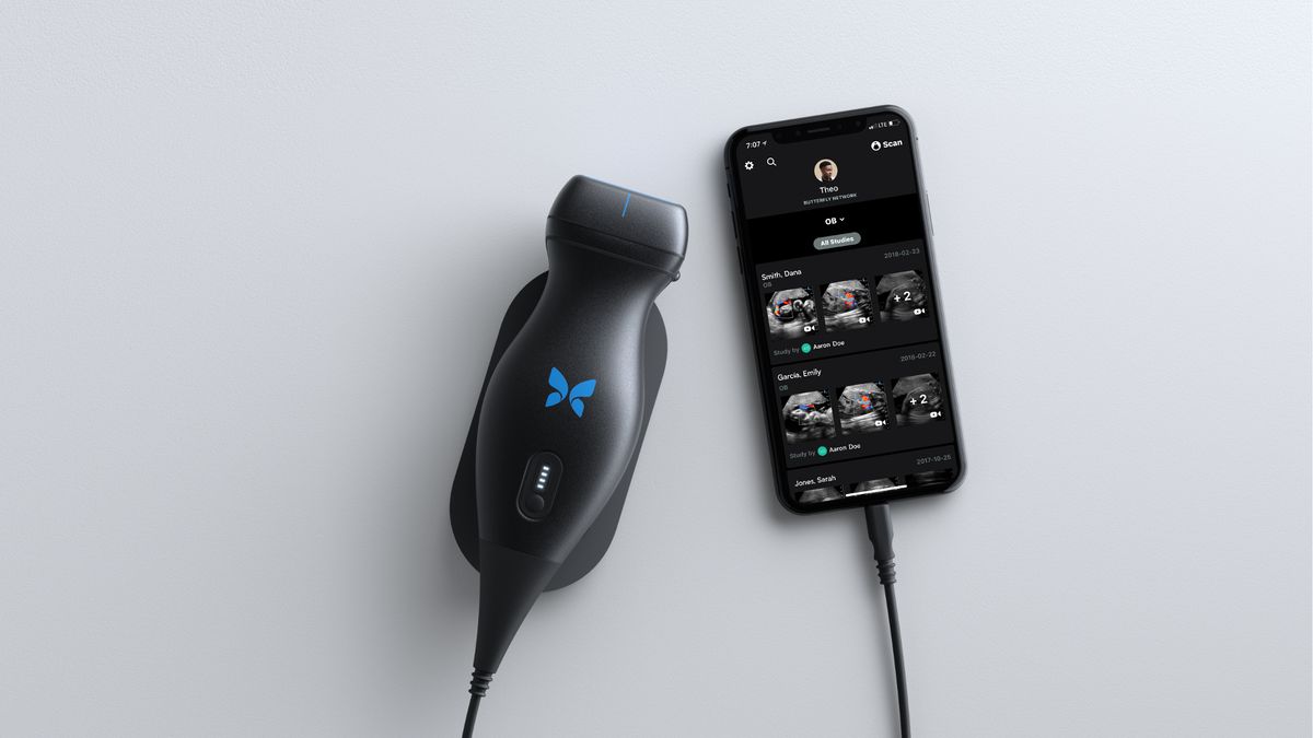 Butterfly iQ is a pocket-sized ultrasound scanner which could ...