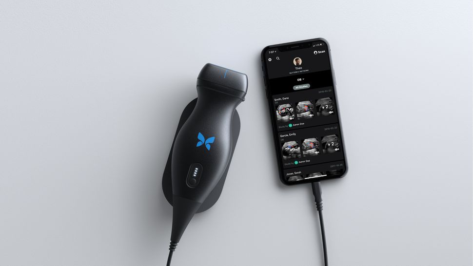 Butterfly iQ is a pocket-sized ultrasound scanner which could ...