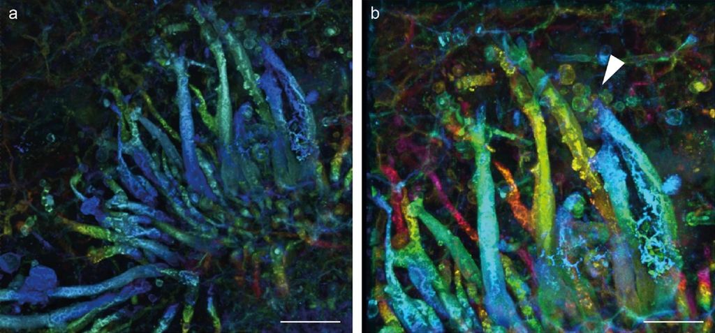 Earliest known parasitic fungus discovered in fossilized plant frozen ...